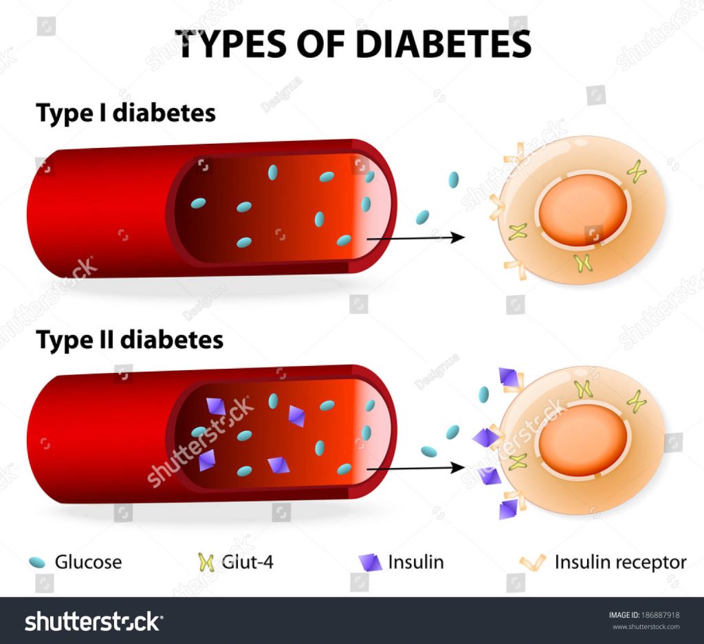 DIABETES – TYPE 1 AND TYPE 2 – Marica Capriotti